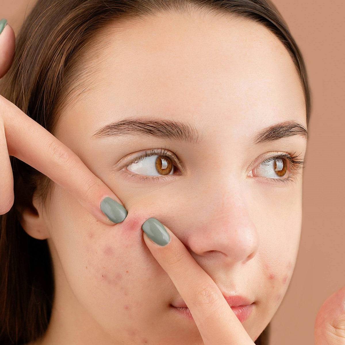 Should I Pop My Pimple? Here’s What You Need to Know – Indeed laboratories